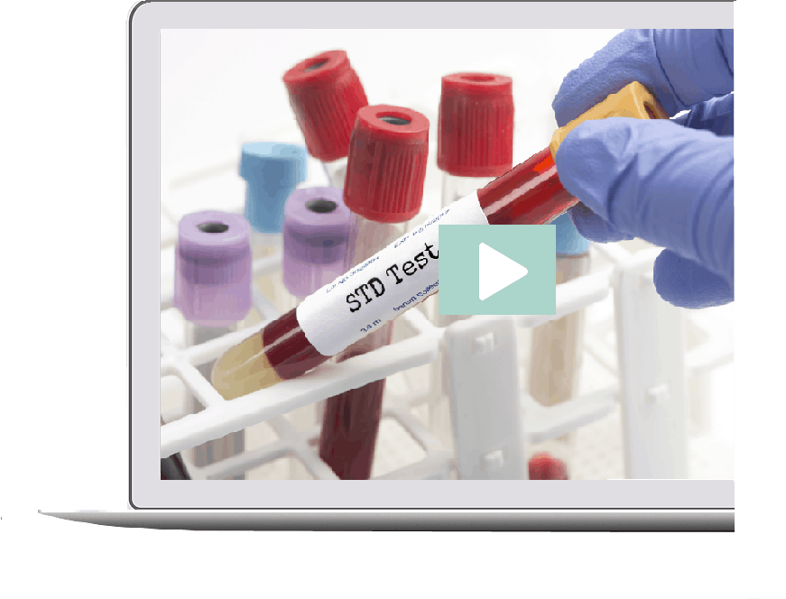 STD Testing Near Me Find Local Test Center By Zip Code